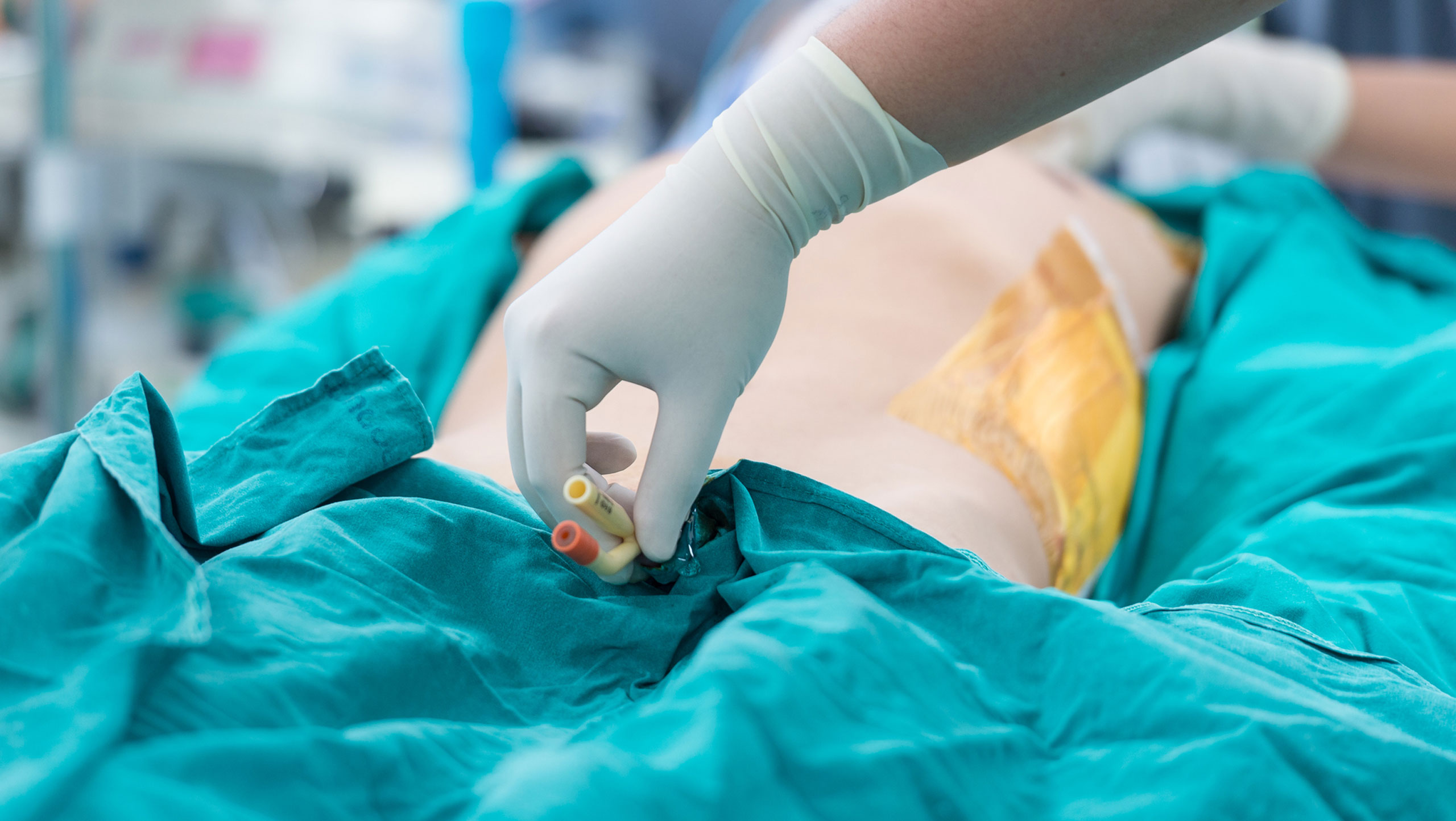 Chirurgie urologique – Clinique Carthagene